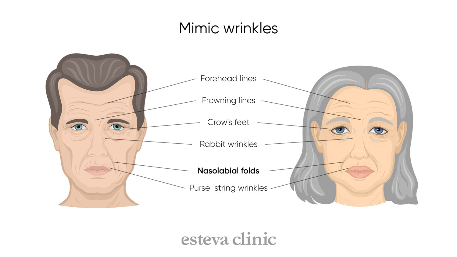 How to prevent the formation of nasolabial wrinkles