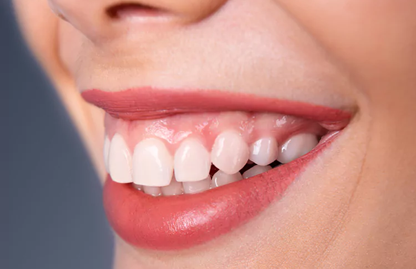 In this article, we will consider in detail what causes an ashen smile ...